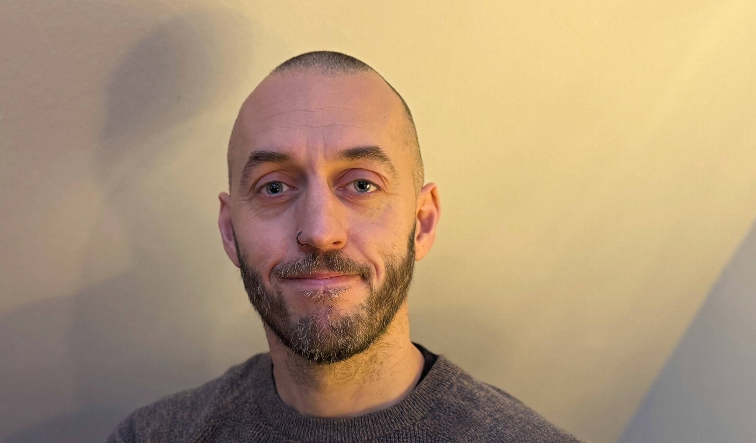 Steffen kan tale foran 1.000 mennesker – men i biffen kan han kun sidde ...