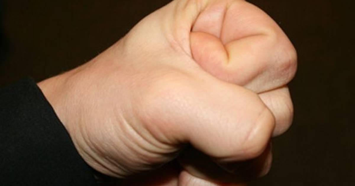 Voldsomt slag brækkede kindben og knogle - Din Avis