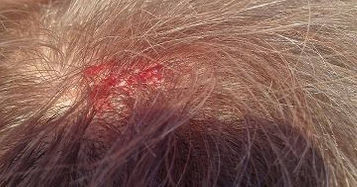 "Det føles som at få en på hovedet" - Din Avis